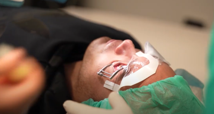 Skidanja dioptrije traje samo 15 minuta, evo kako izgleda