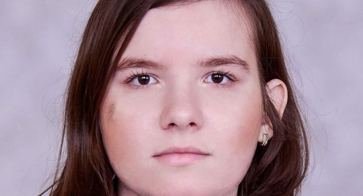 Pokrenut apel za studenticu Dženetu Hamzić koja je osuđena na život sa štakama